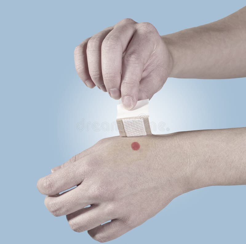 Adhesive Healing Plaster on Hand. Stock Photo - Image of bandage ...