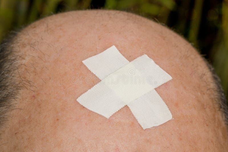 Adhesive patch on forehead stock image. Image of plaster - 205498795