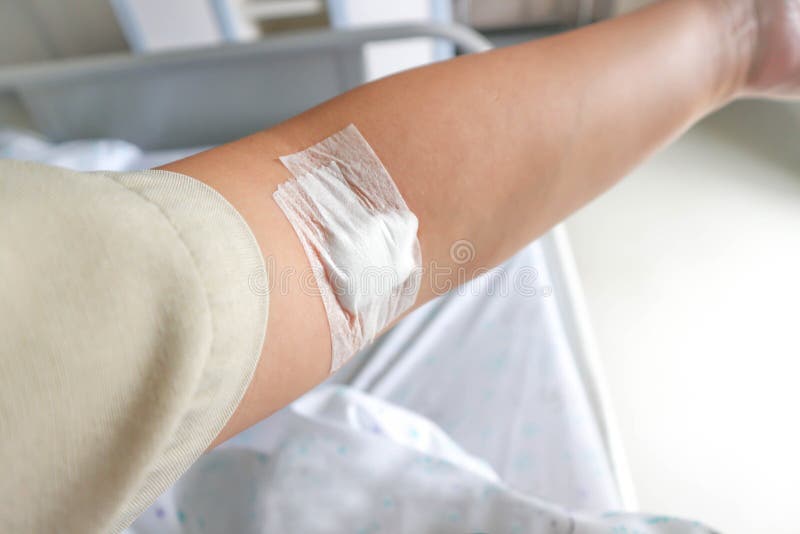 Adhesive plaster on arm stock photo. Image of wounded - 98856436