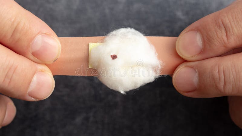 Adhesive Plaster with Cotton Wool after an Injection on the Arm Stock ...