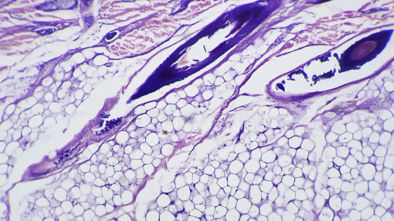 Adipose Human Tissues in Section Magnified Under Light Micrograph 200x ...