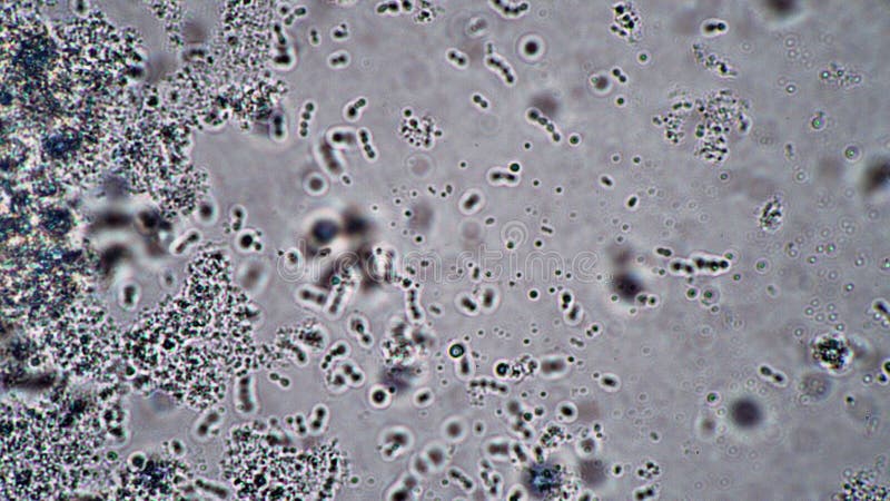 Adjusting the Focus of the Microscope on Lacto Bacteria and Bacilli ...