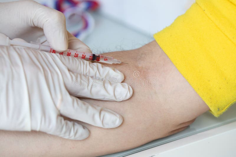 Administration of Medication in a Arm of a Man Stock Image - Image of ...