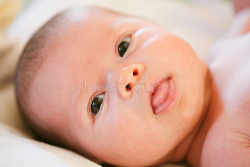 Baby with Allergic Diathesis Stock Image - Image of childhood, facial ...