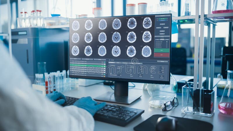 Advanced Brain Research Laboratory: Neurology Scientist is Using ...