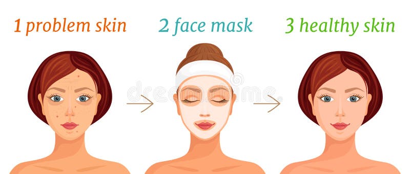 Illustration of an Aging Face. the Process of Withering Skin. Vector ...