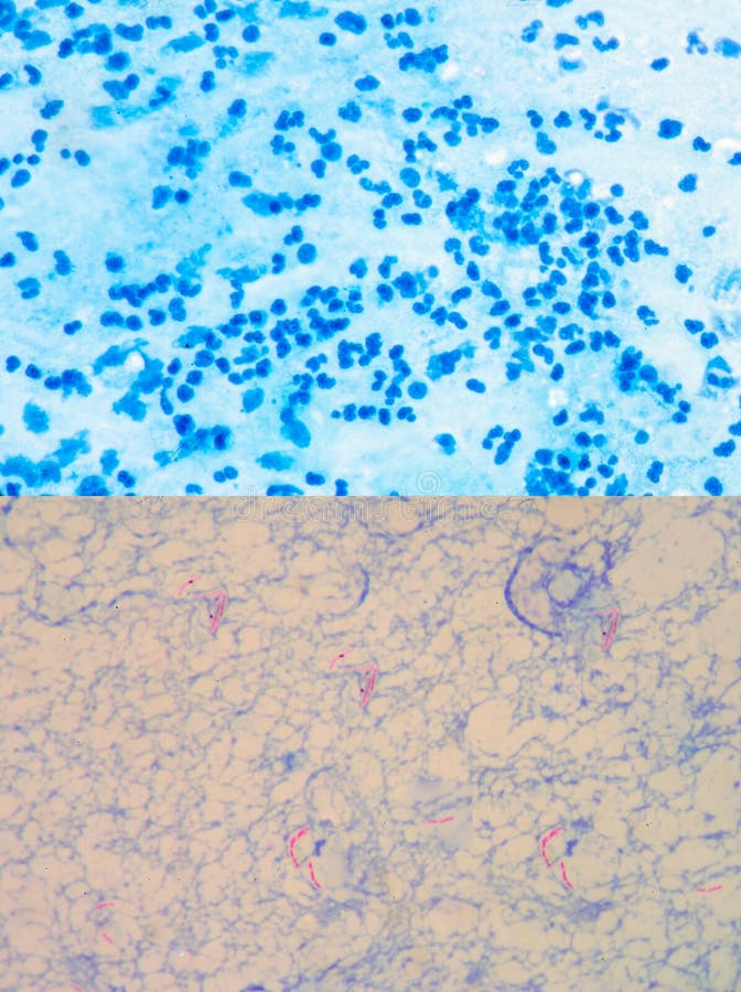 E Coli Acid Fast Stain