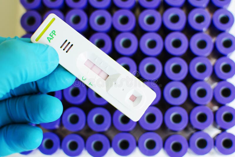 Afp Blood Test Stock Photos - Free & Royalty-Free Stock Photos from ...