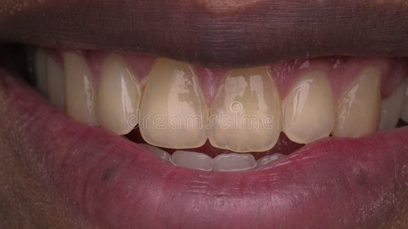 Man Shows His Mouth, Tongue and Teeth. Stock Footage - Video of move ...