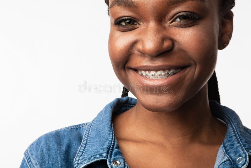 Portrait Young Black Woman Orthodontist Braces Stock Photos - Free ... Portrait Young Black Woman Orthodontist Braces Stock Photos - Free ...