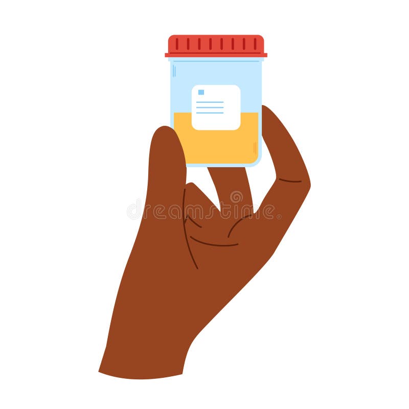 African Hand Holds Container with Pee Sample Inside. Medical Urine ...