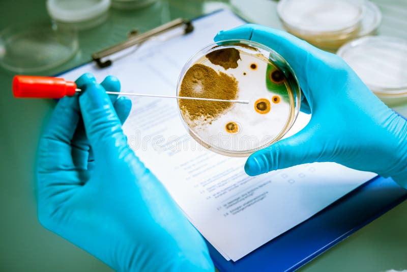 Agar Plate with Growing Germs Stock Photo - Image of bacteria, growth ...