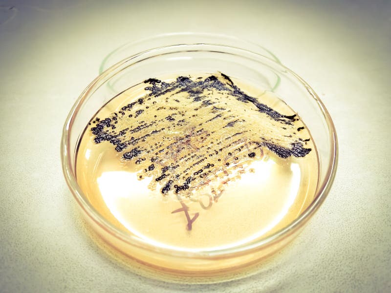 109 Staphylococcus Aureus Pathogen Stock Photos - Free & Royalty-Free ...