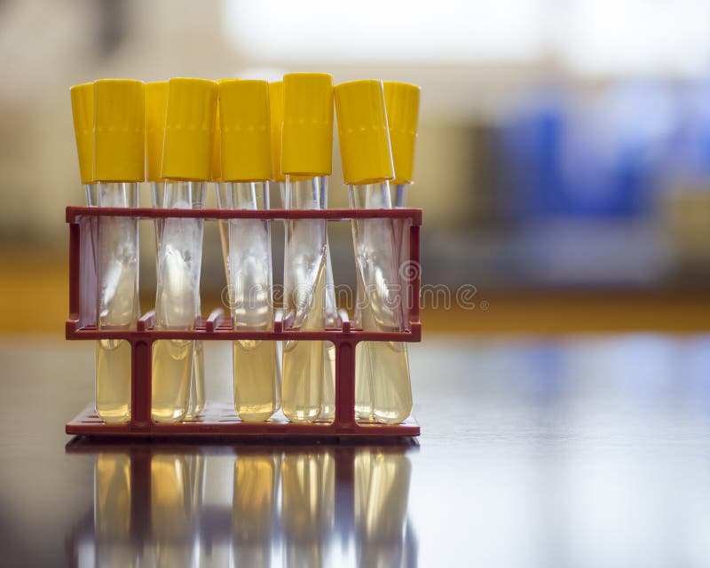 Agar slants stock photo. Image of life, inspection, colonies - 164964250