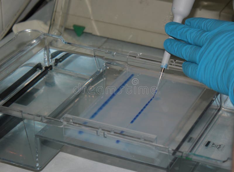 DNA test in agarose gel stock photo. Image of medical - 54717912