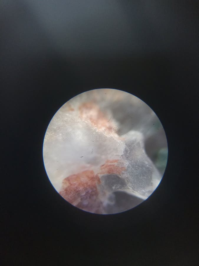 Agate Stone Under a Microscope. Stock Photo - Image of figure, hazelnut ...