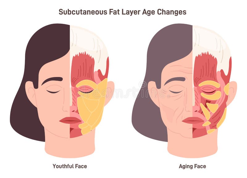 Age-related Skin Changes. Aging Process, Subcutaneous Fat Layer Changes ...