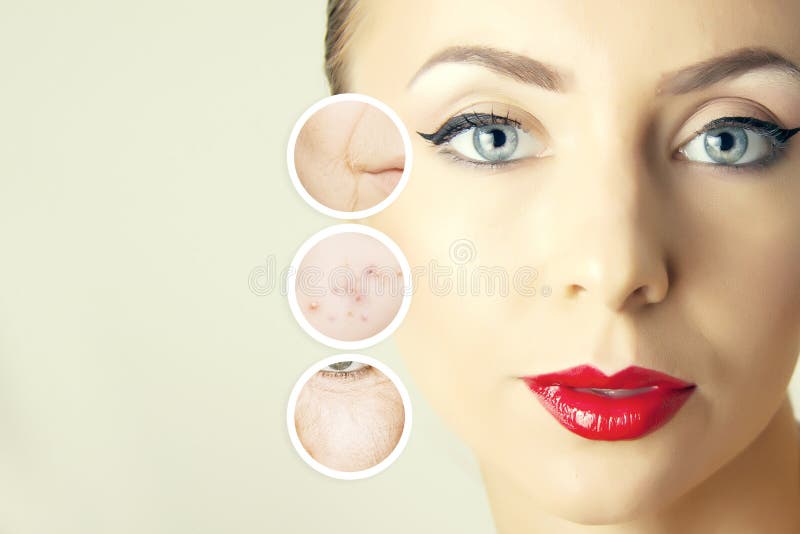 Aging Problems of Face Skin Stock Image - Image of skin, health: 110701507