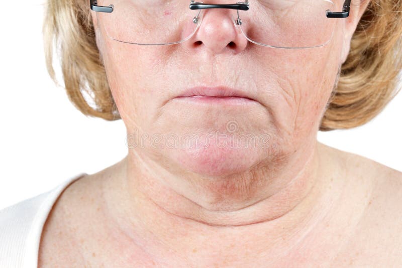 Aging skin stock image. Image of wrinkled, chin, female - 20258393