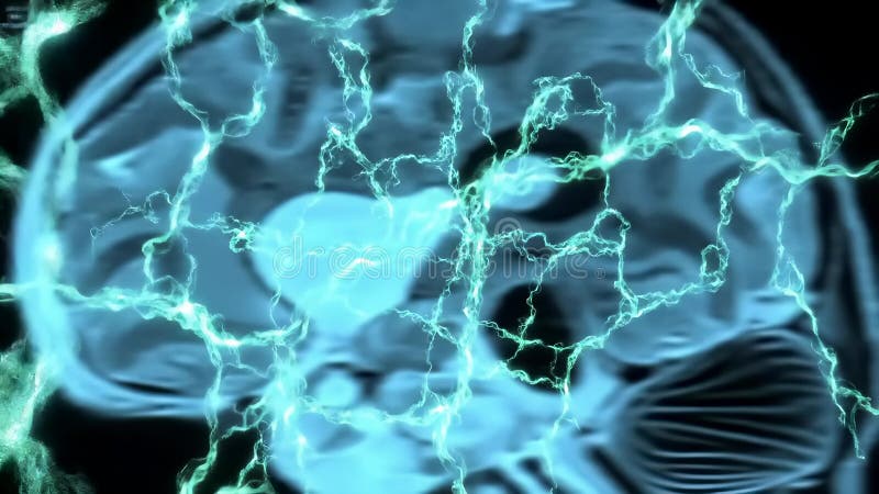 AI Electric Brain Activity Shows Neural Pathways Stock Video - Video of ...