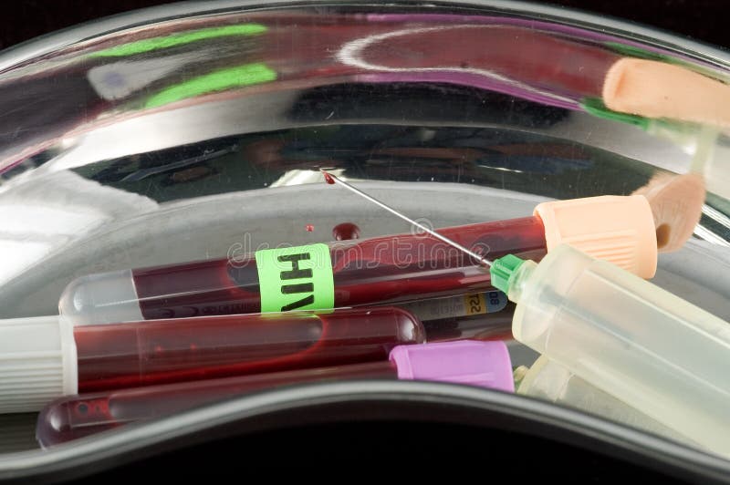 Aids test stock image. Image of blood, container, aids - 613461