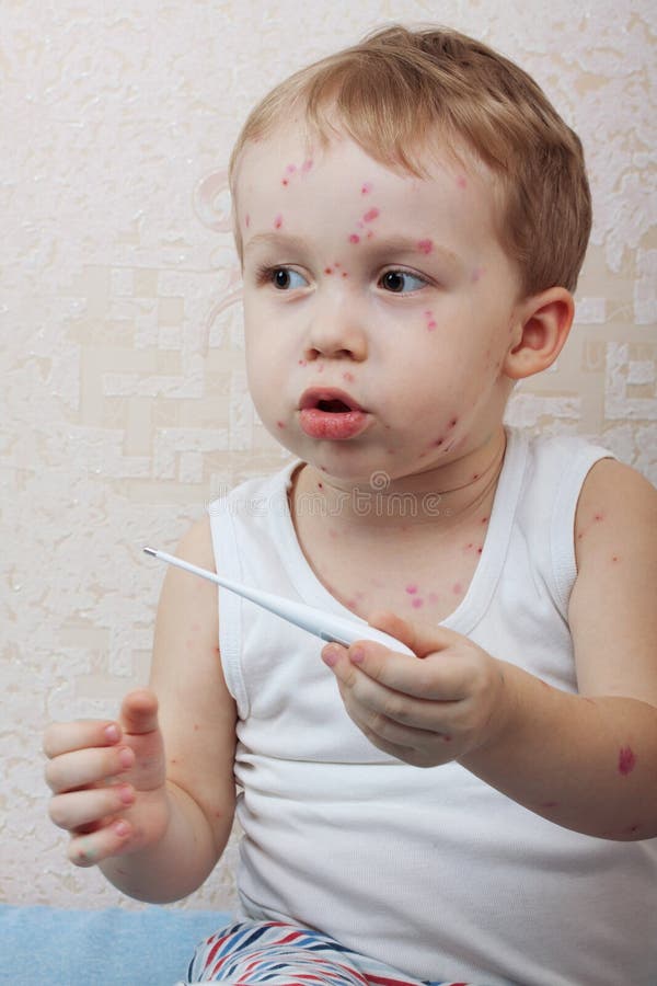 Ailing child stock image. Image of ailing, sick, urticaria - 23285567
