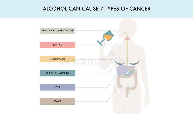 Alcohol Can Cause Different Cancer Stock Vector - Illustration of ...