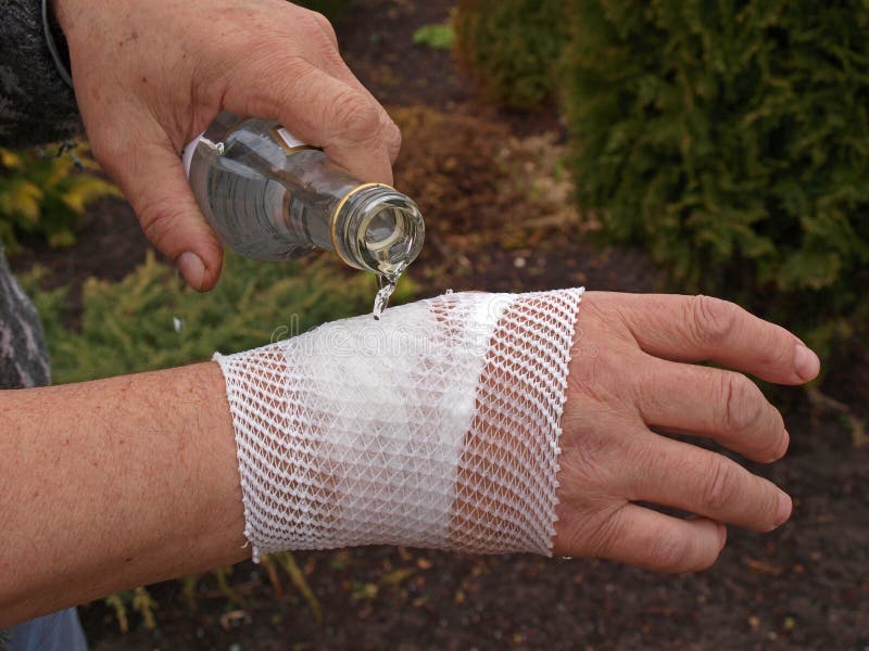 Alcohol compress stock photo. Image of spirit, pain, compress - 24500262
