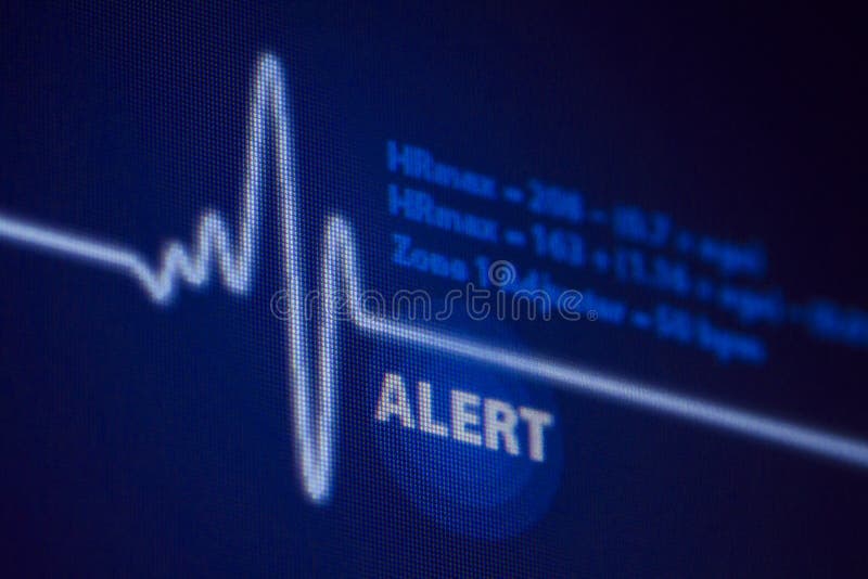 Alert Warning Sign Heart Beat Stock Photo - Image of proximity, pulse ...
