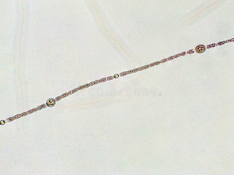 Heterocyst Stock Photos - Free & Royalty-Free Stock Photos from Dreamstime