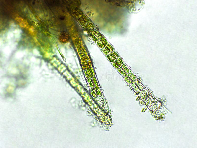 Algae Under Microscopic View Stock Photo - Image of environmental ...