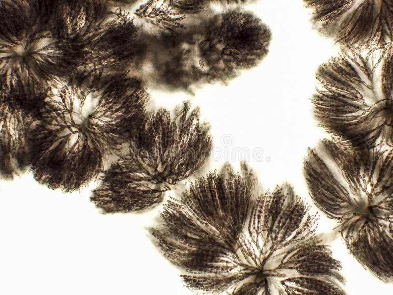 Algae Under Microscopic View, Freshwater Red Algae, Rhodophyta ...