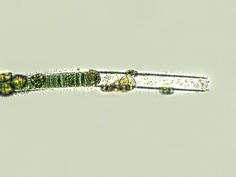 Algues Filamenteuses Vertes Bleues Sous Vue Microscopique Image stock ...