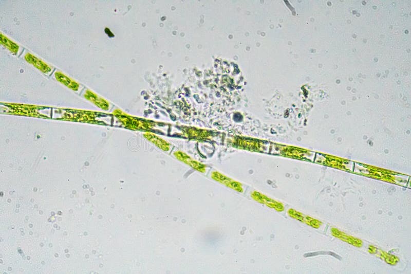 Algues Sous La Vue Microscopique Photo stock - Image du recherche ...