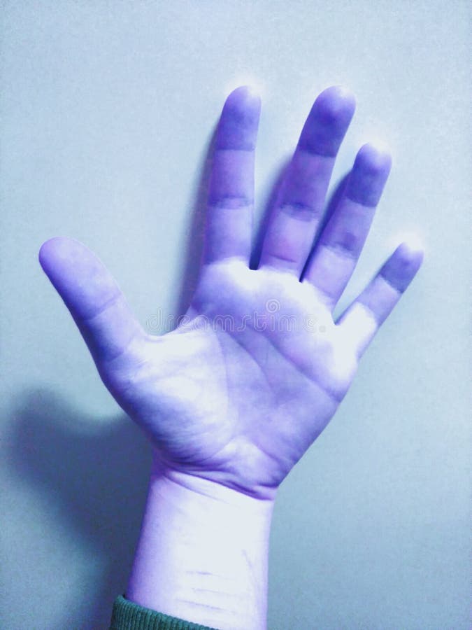 Alien Hand Syndrome. Mature Man Trying To Control His Hand Stock Photo ...