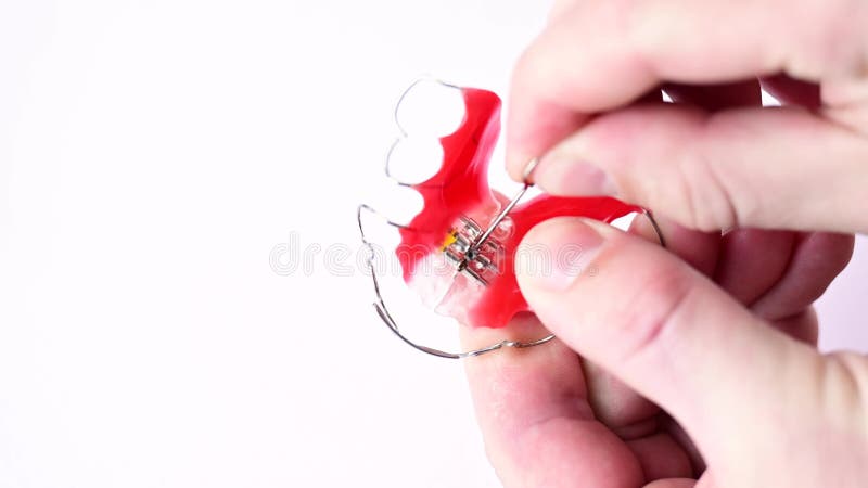 Alignment of Teeth, Twisting of a Plate by Means of a Special Key, Care ...