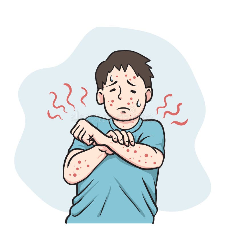 Allergic Reactions and Skin Irritations Stock Vector - Illustration of ...