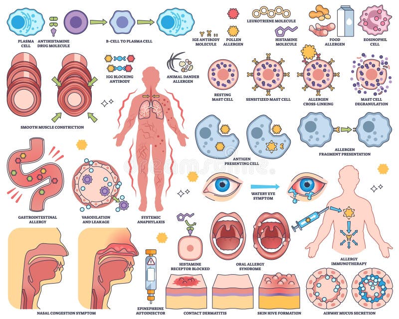 Allergic Response and Hypersensitivity are Shown with Immune Cells ...