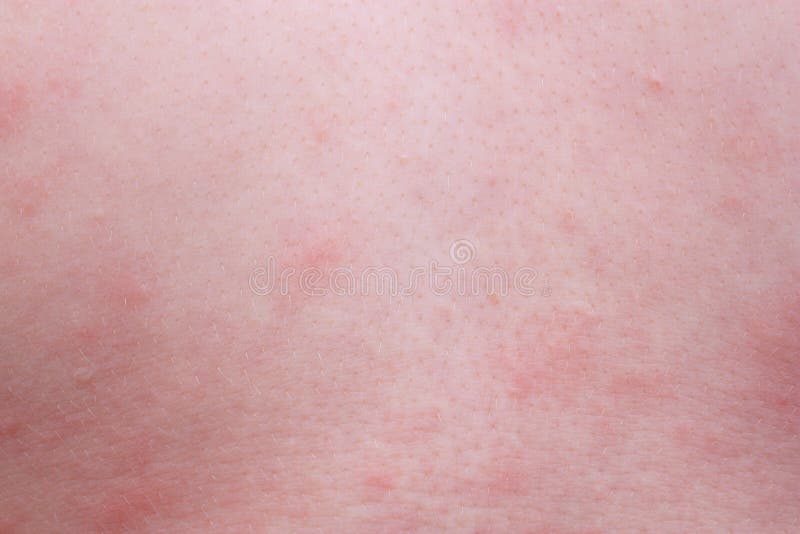 Dry Skin stock photo. Image of macro, flake, health, skin - 10610394