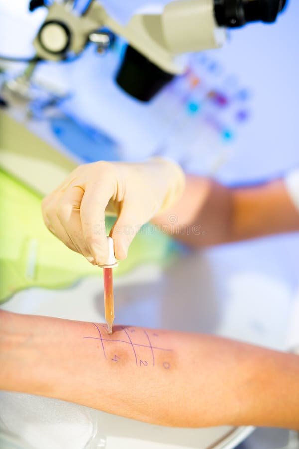Allergy - skin tests stock photo. Image of liquid, allergic - 67937366