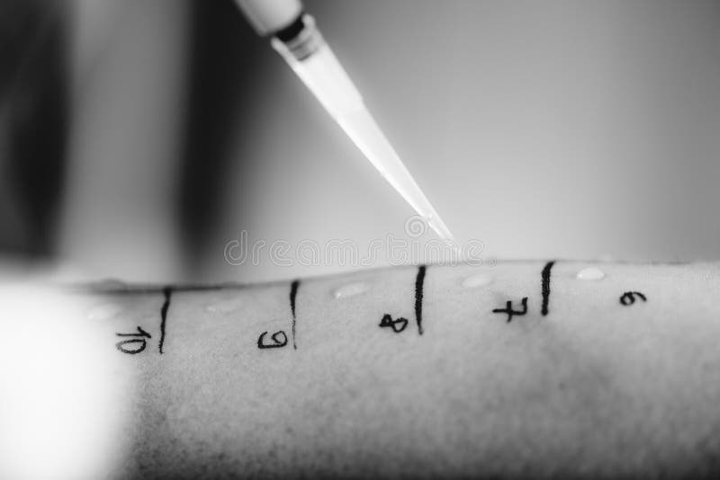 Allergy - Skin Testing stock photo. Image of laboratory - 270628932