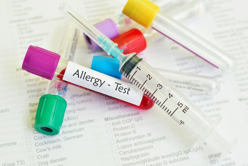 Allergy test stock image. Image of patient, testing, tubes - 69307095