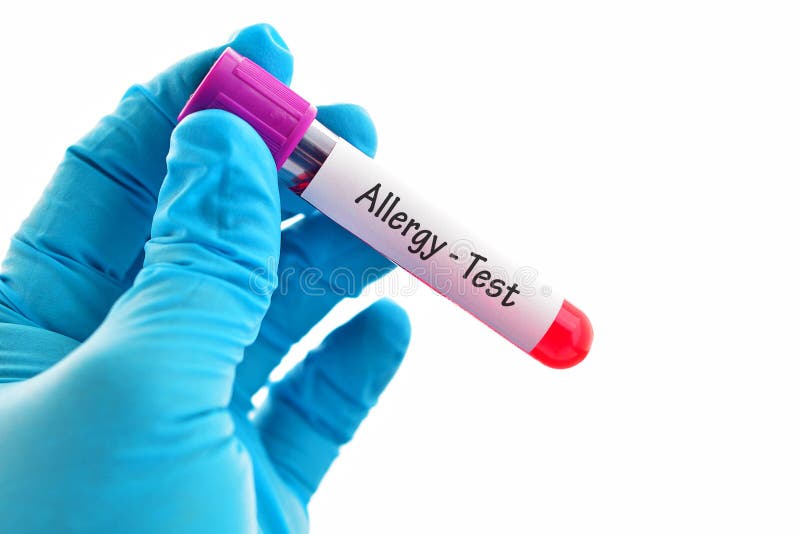Allergy test stock photo. Image of hematology, science - 69307466