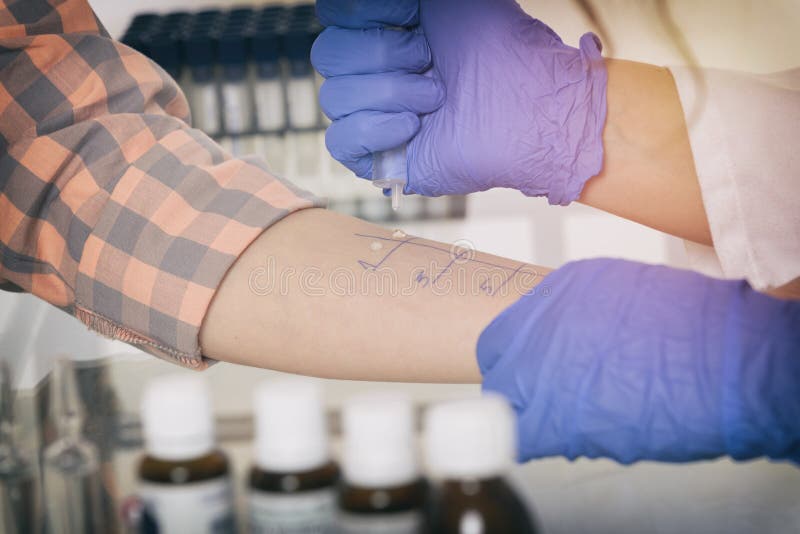 Allergy Tests in Laboratory Stock Image - Image of allergisation, care ...