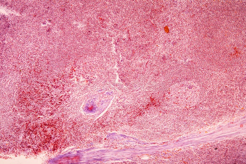 Almond Tonsils in Cross Section Stock Photo - Image of palate ...