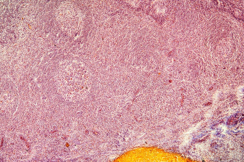 Almond Tonsils in Cross Section Stock Image - Image of organs, palate ...