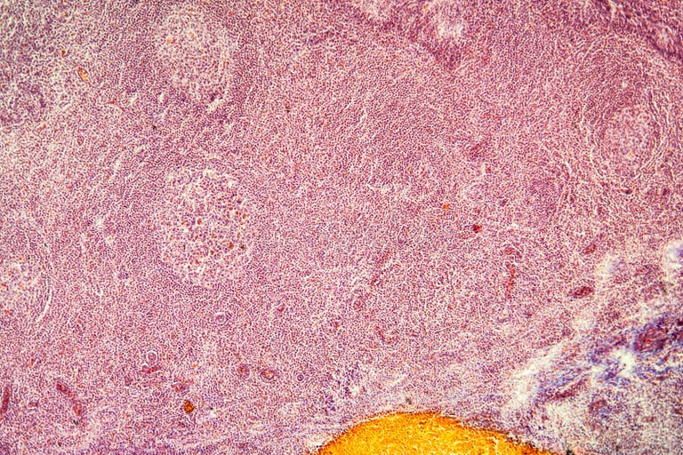 Almond Tonsils in Cross Section Stock Image - Image of organs, palate ...