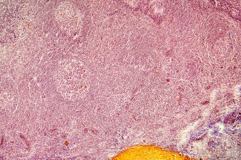 Almond Tonsils in Cross Section Stock Image - Image of organs, palate ...