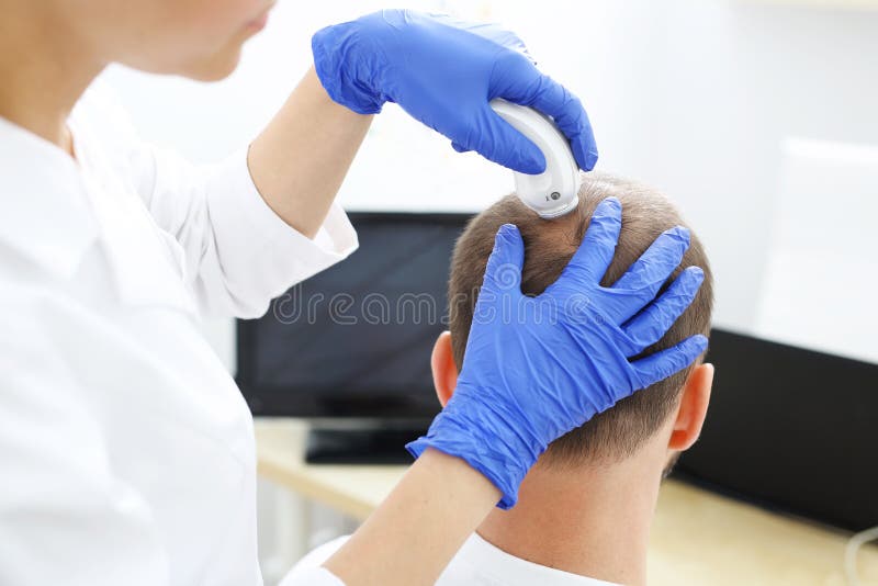 Microscopic Analysis of the Condition of Hair and Scalp. Stock Photo ...