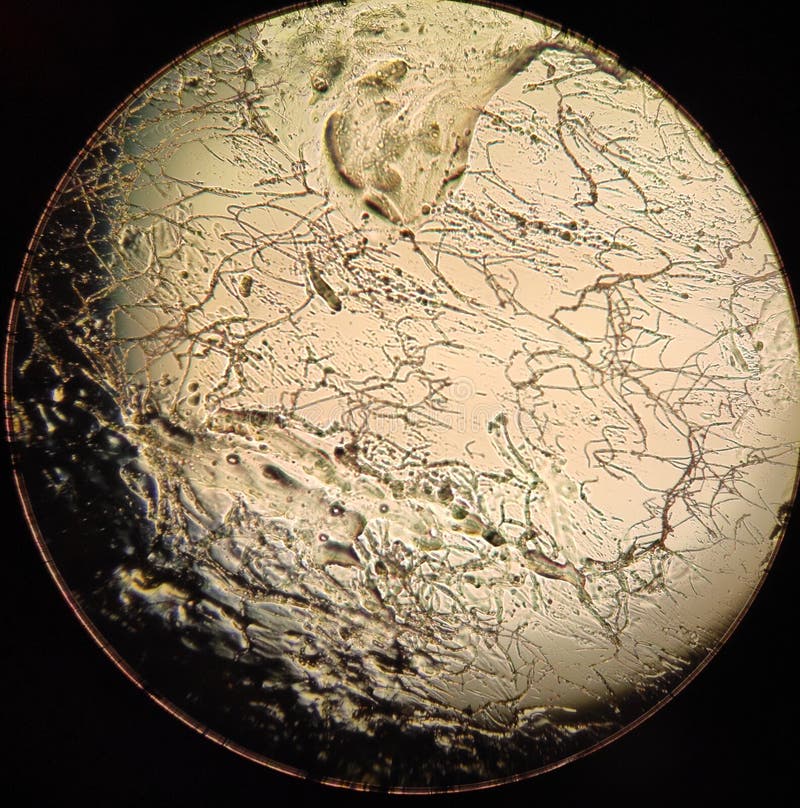Alternaria Fungal Mycelium Under the Microscope Stock Photo - Image of ...